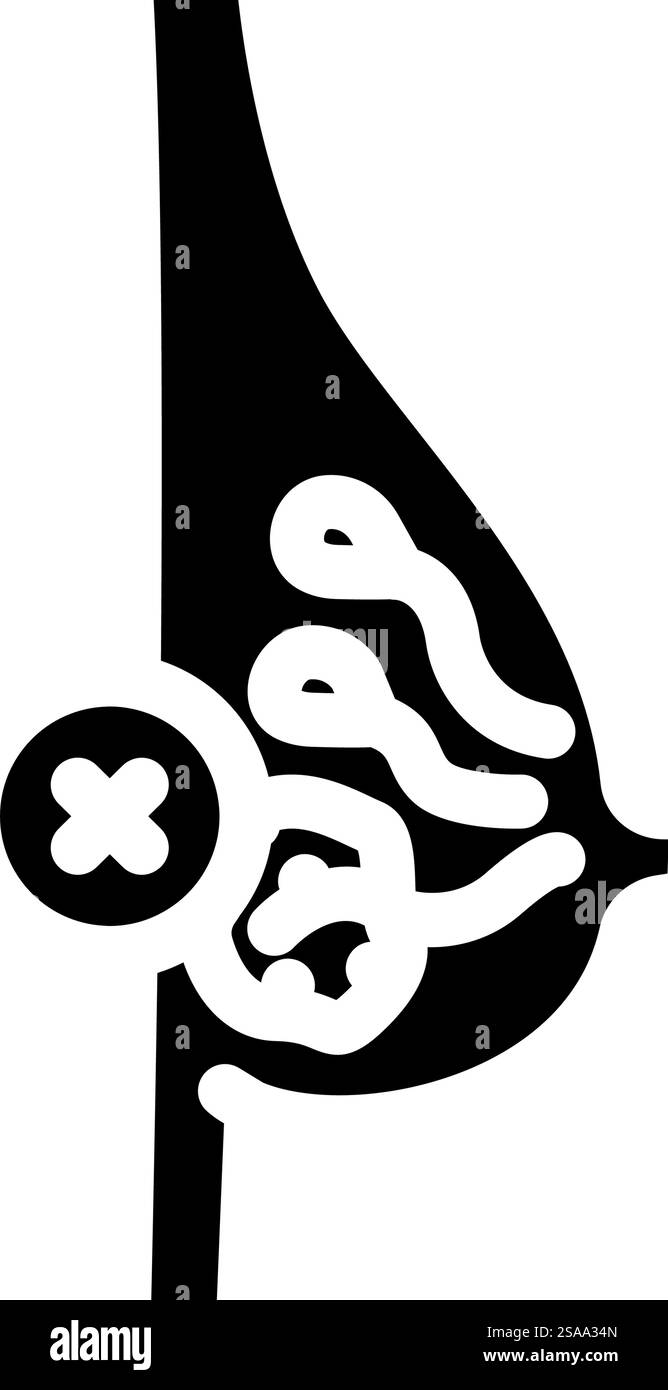 lumpectomy surgery glyph icon vector. lumpectomy surgery sign. isolated ...