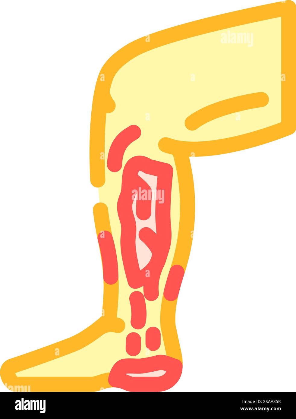 Lacerations Stock Vector Images - Alamy