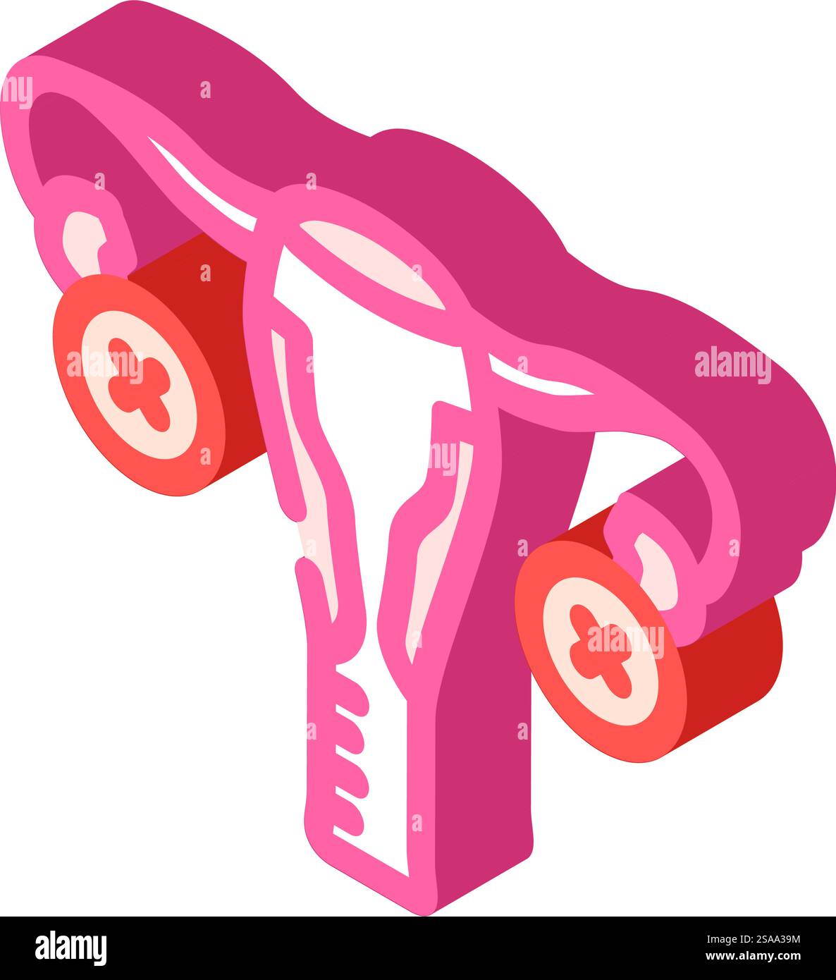 oophorectomy surgery isometric icon vector. oophorectomy surgery sign ...
