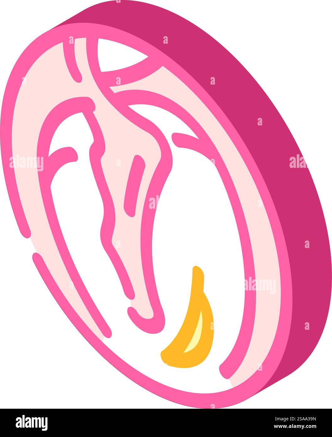 myringotomy surgery isometric icon vector. myringotomy surgery sign ...