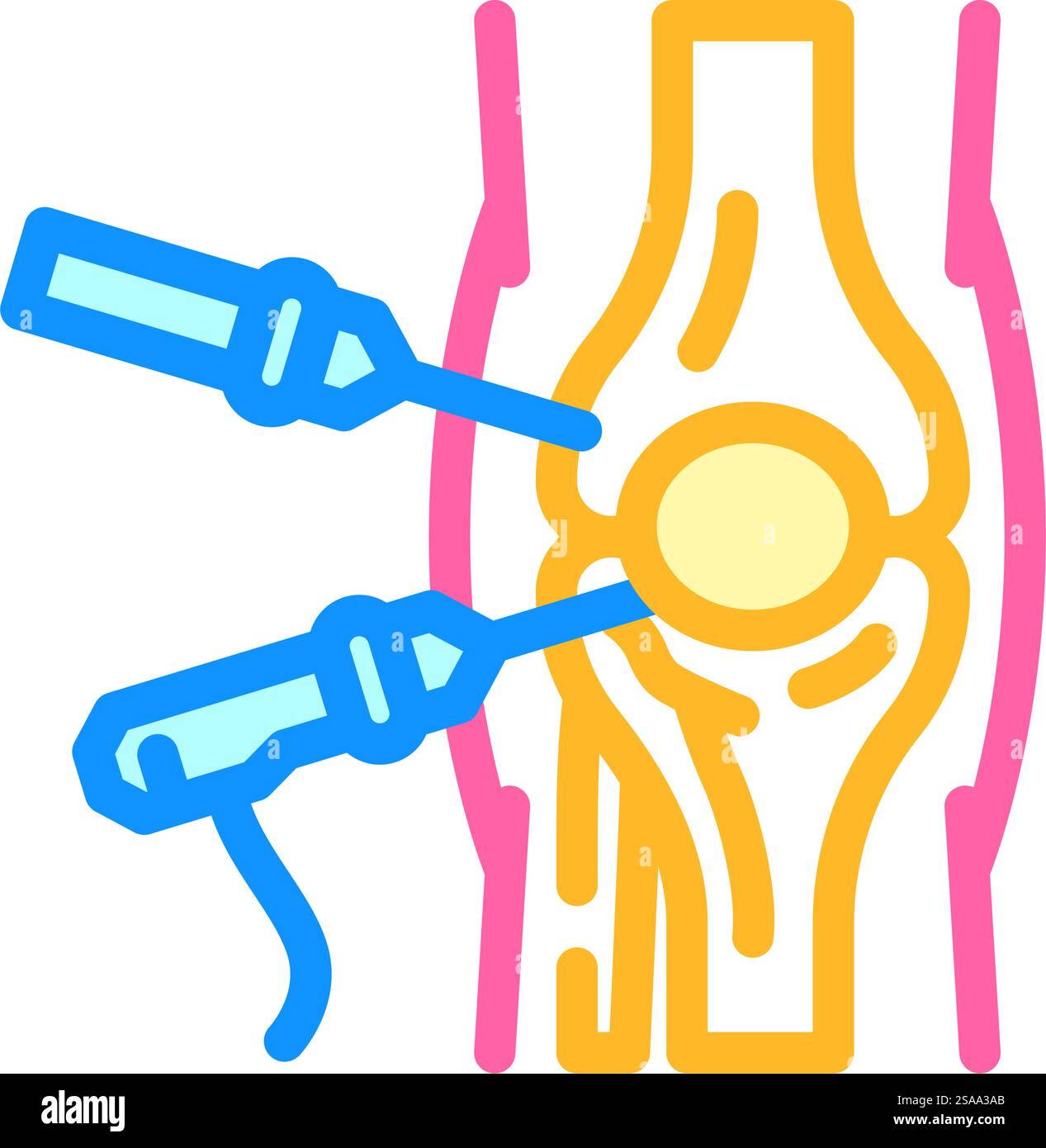 arthroscopy surgery color icon vector. arthroscopy surgery sign ...