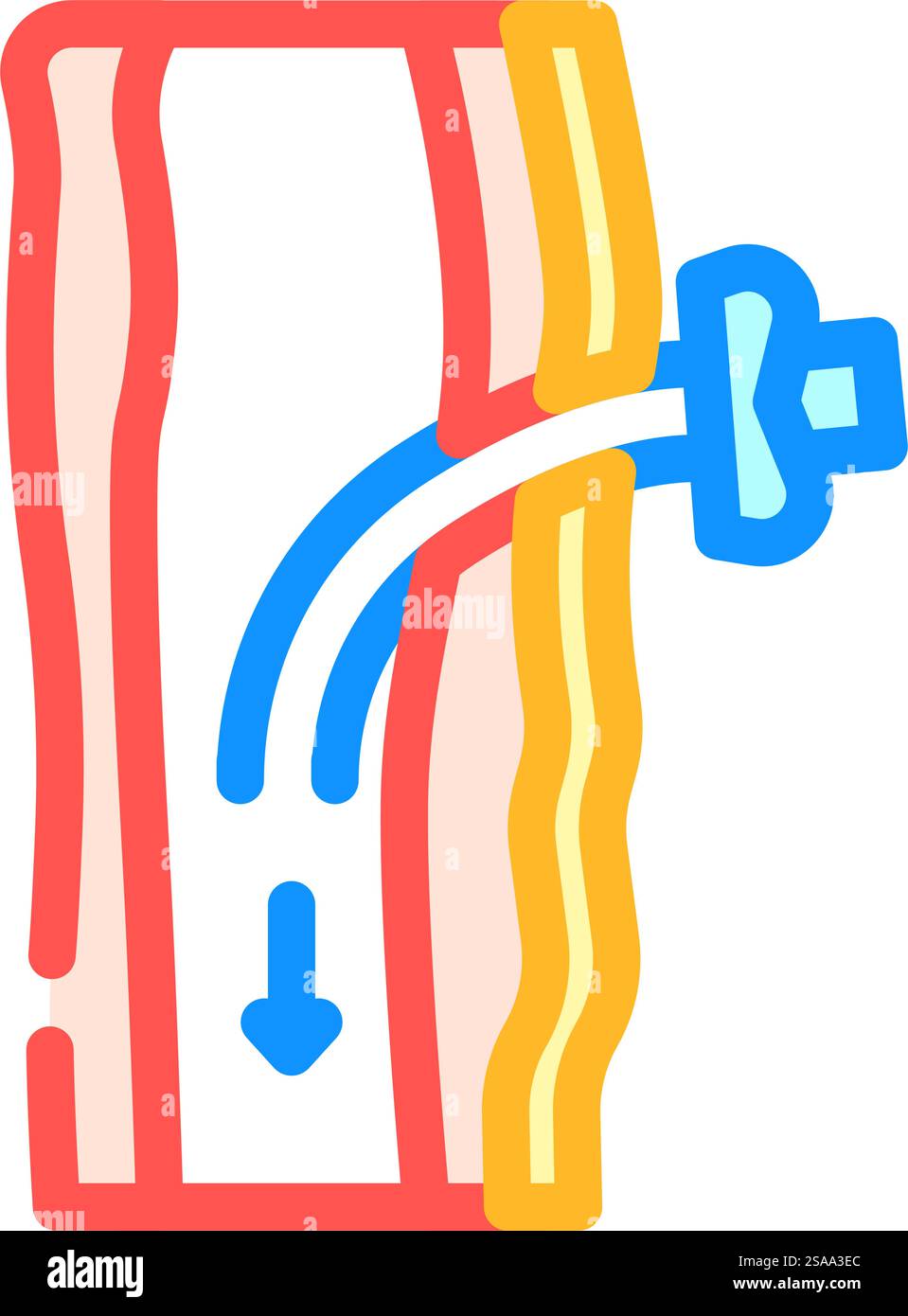 tracheostomy surgery color icon vector. tracheostomy surgery sign ...