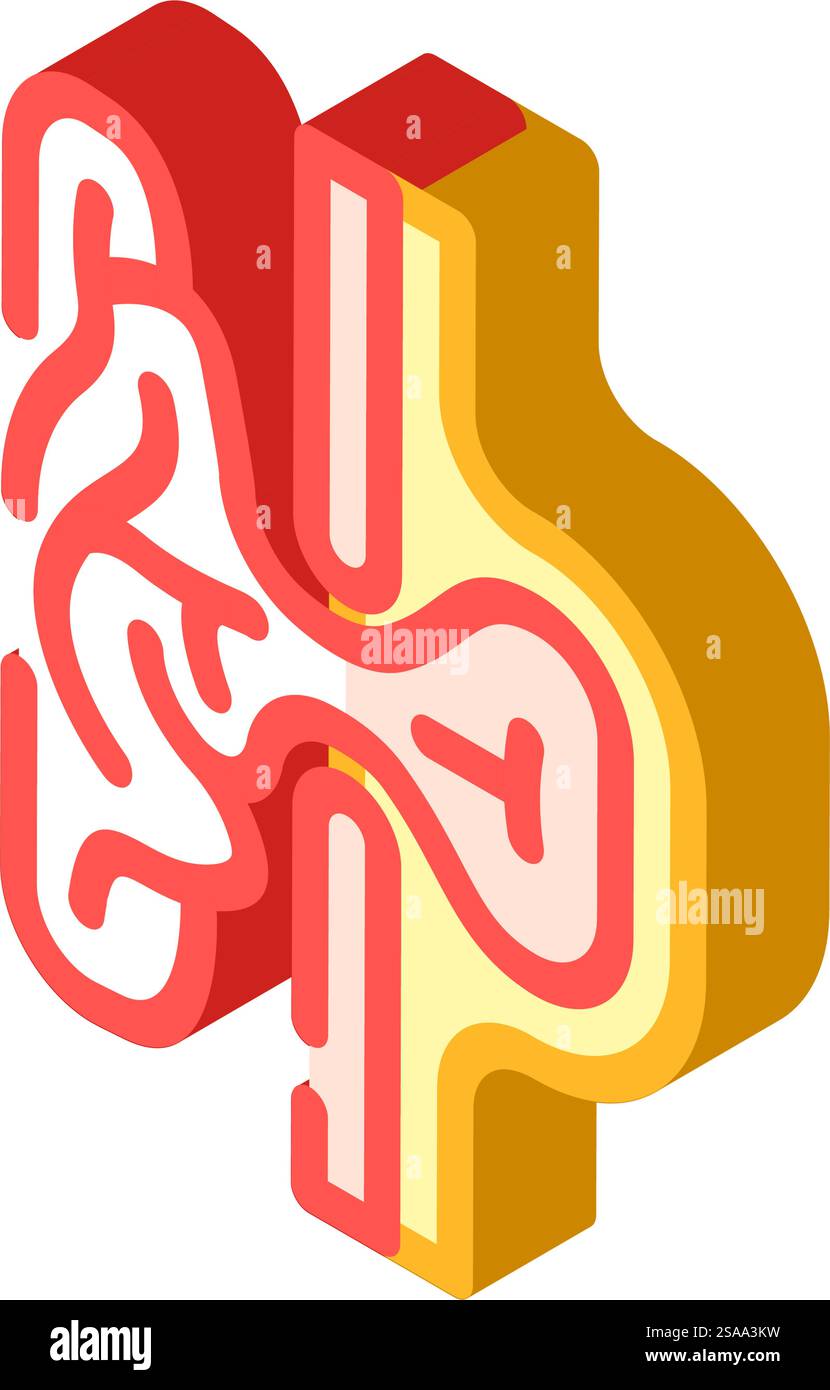 inguinal hernia repair surgery isometric icon vector. inguinal hernia ...