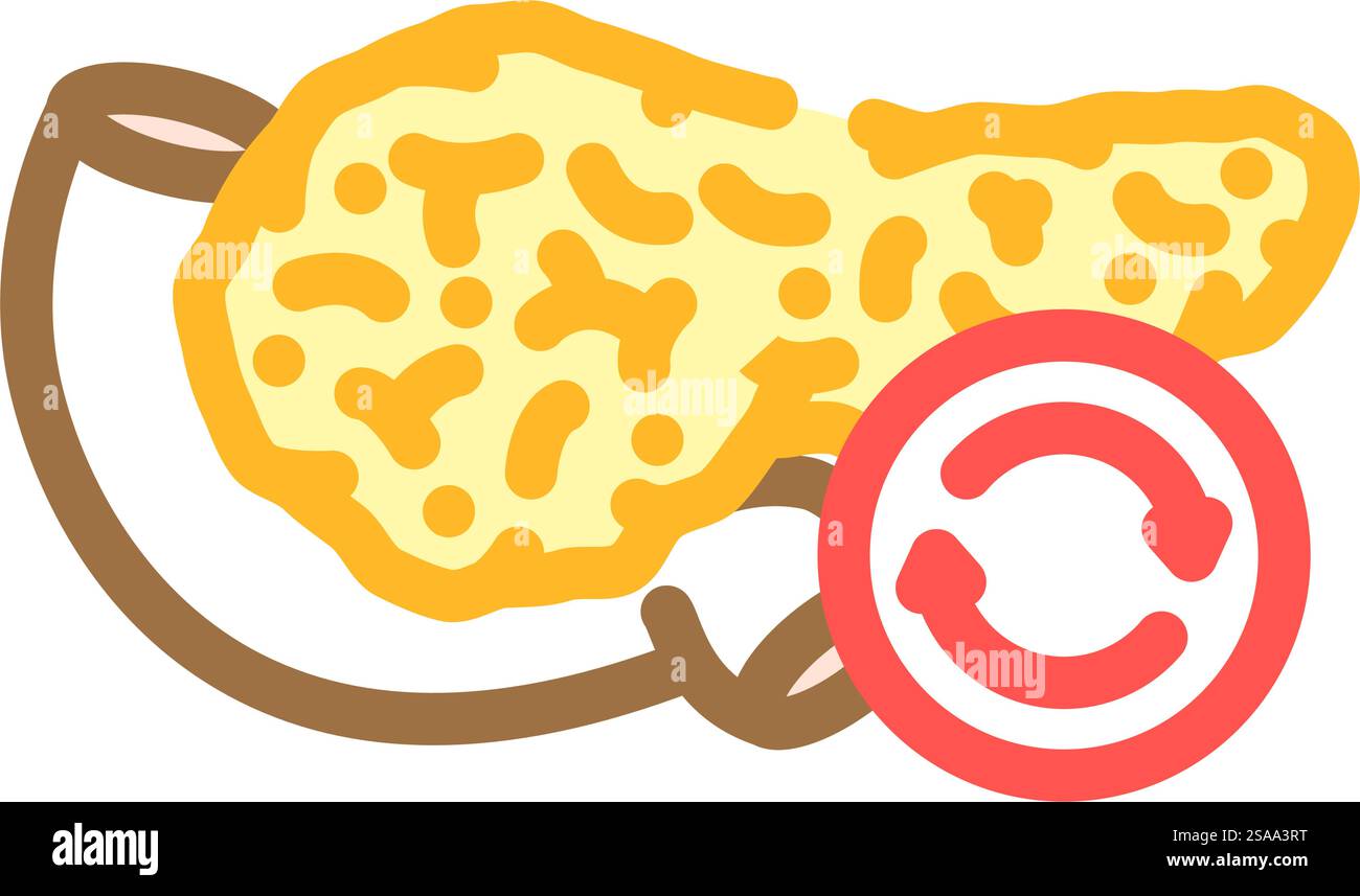 pancreas transplant surgery color icon vector. pancreas transplant ...