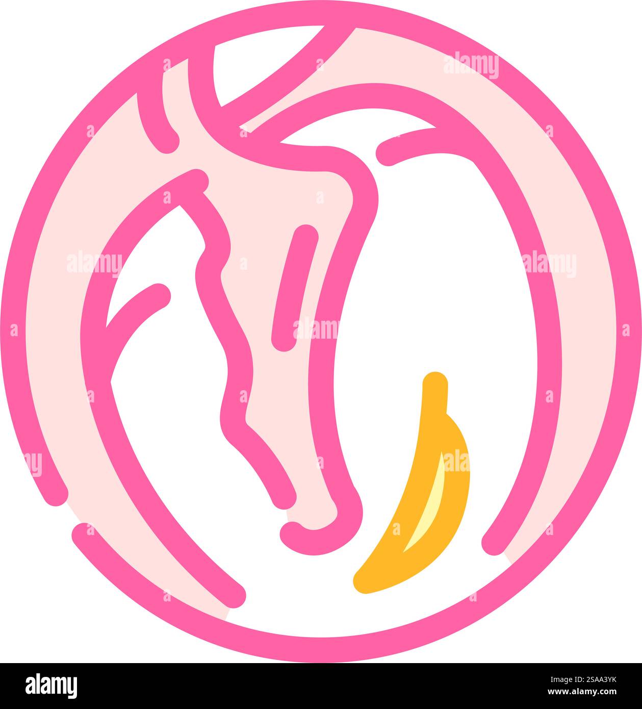 Myringotomy Stock Vector Images - Alamy