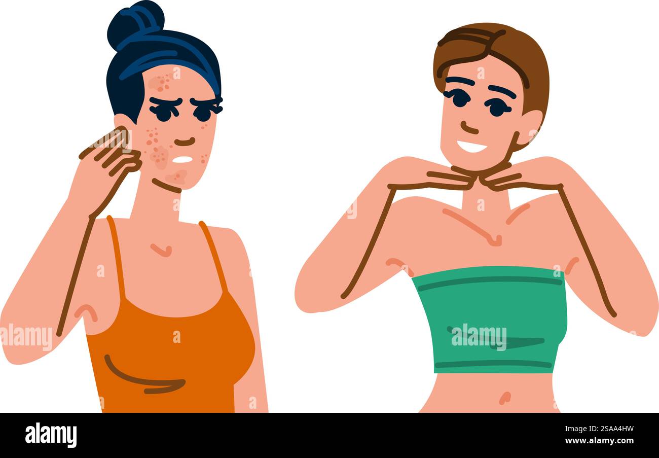 transformation acne before after vector. clear breakout, healing ...