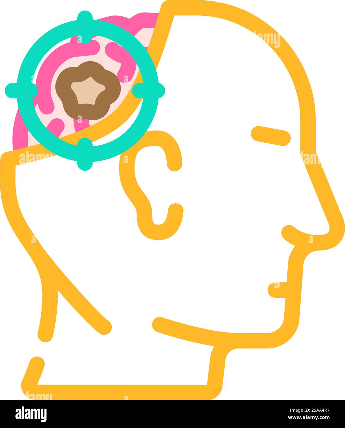 tumor removal cancer treatment color icon vector. tumor removal cancer ...