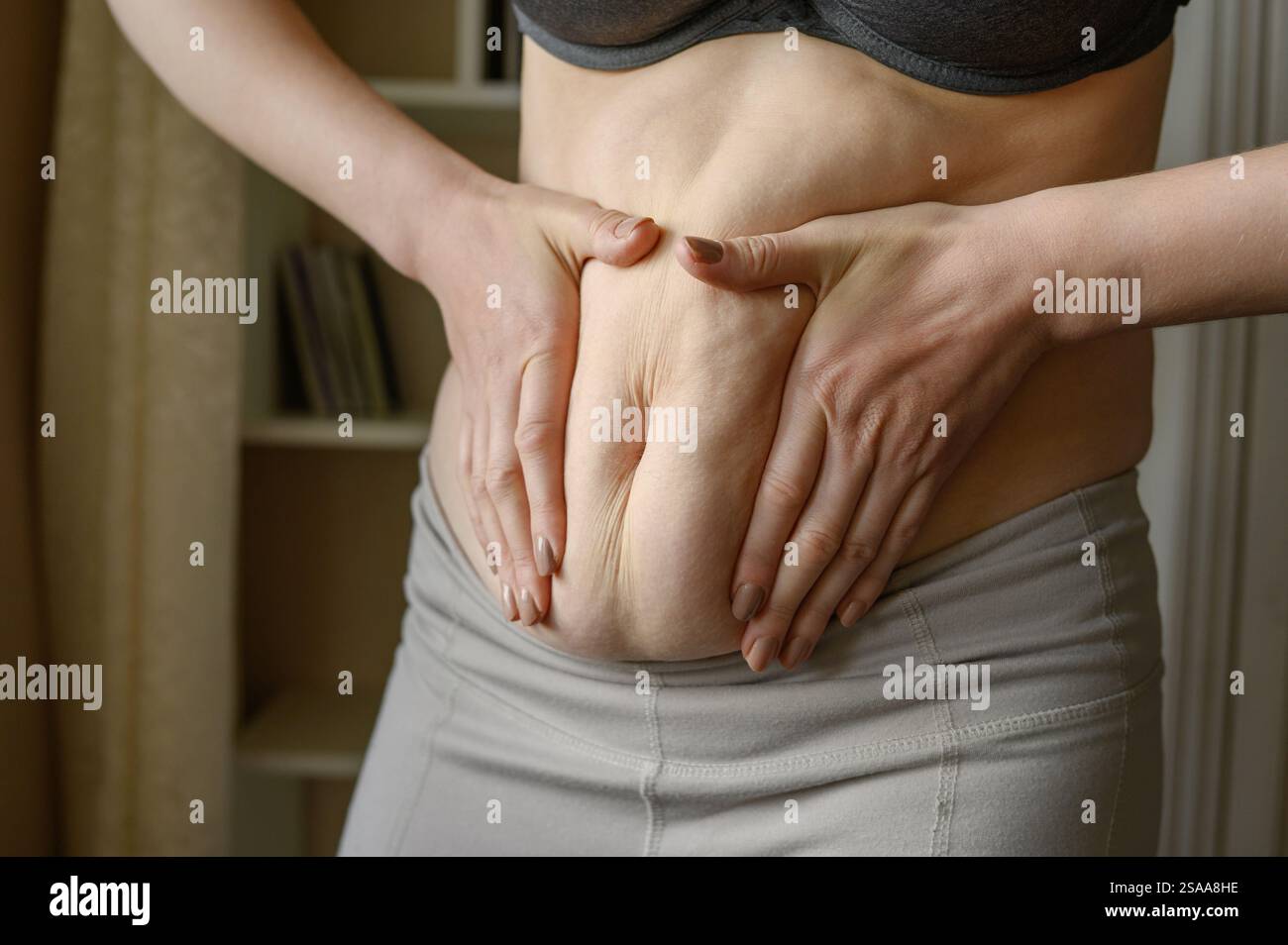 Fat woman squeezes belly fat, fat folds appear, close-up. Diet concept ...
