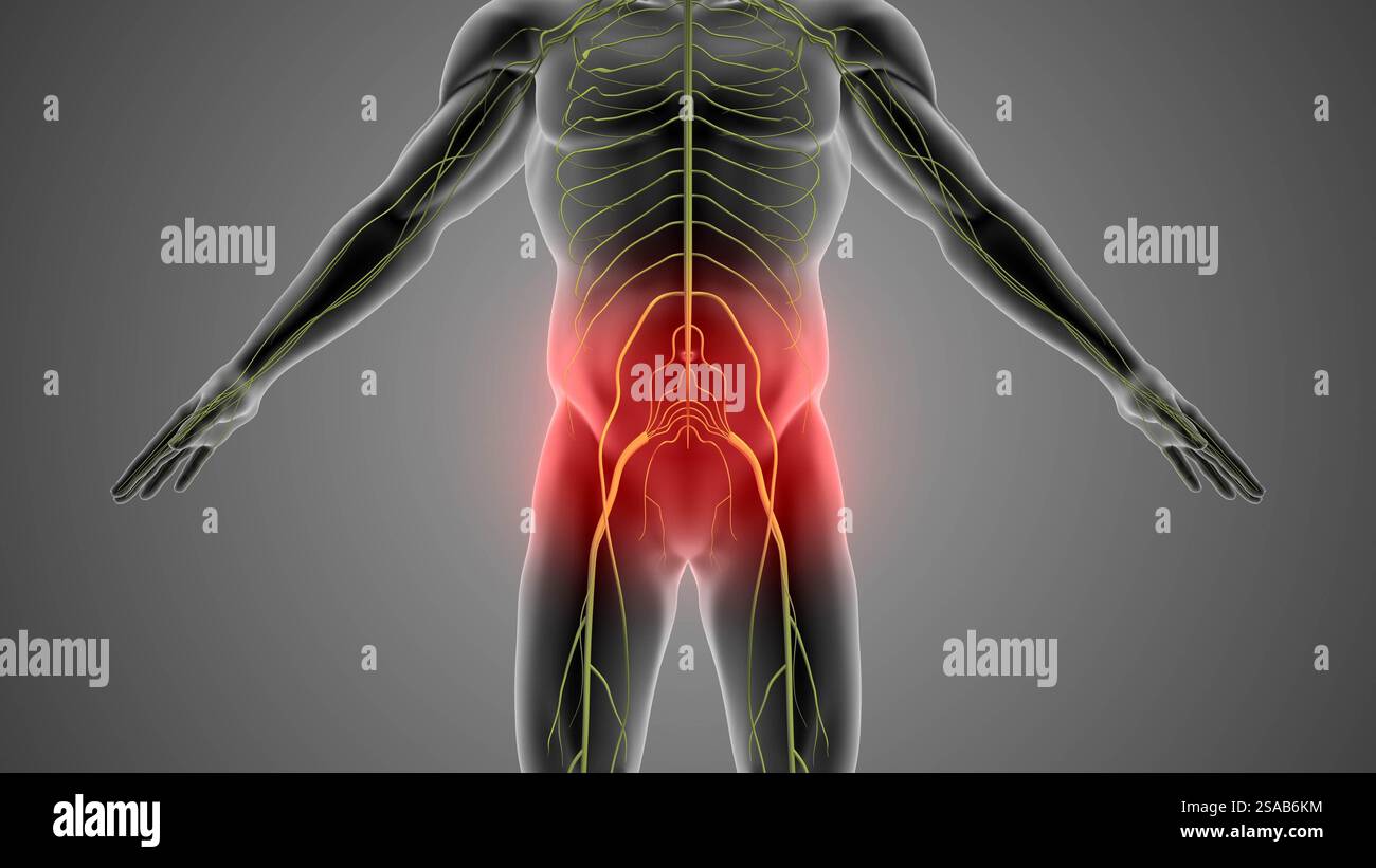 Guillain Barre Syndrome Causes waist pain Stock Photo - Alamy