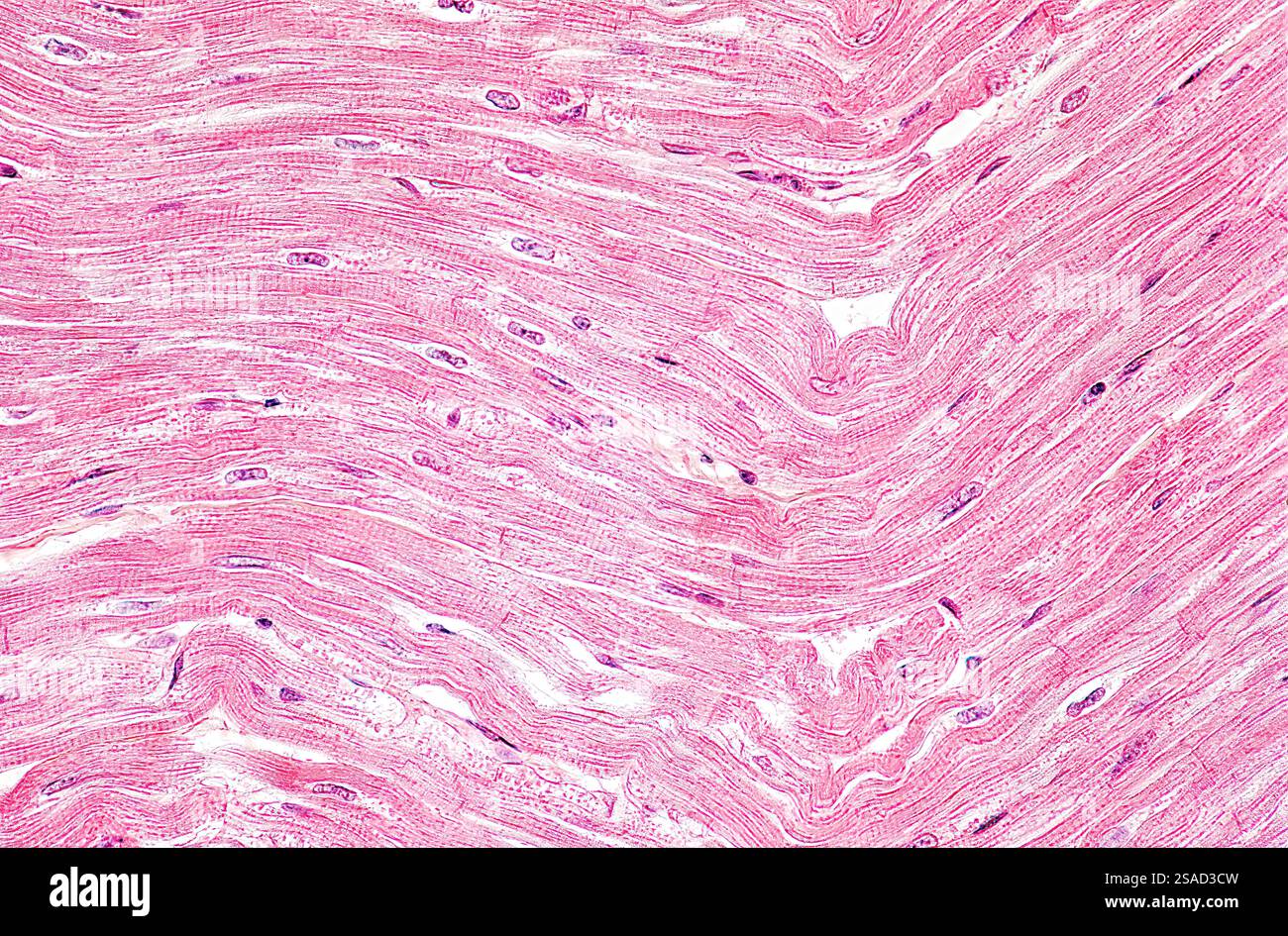 Human cardiac muscle tissue, imaged at 100x magnification, showing striated muscle fibers and ...