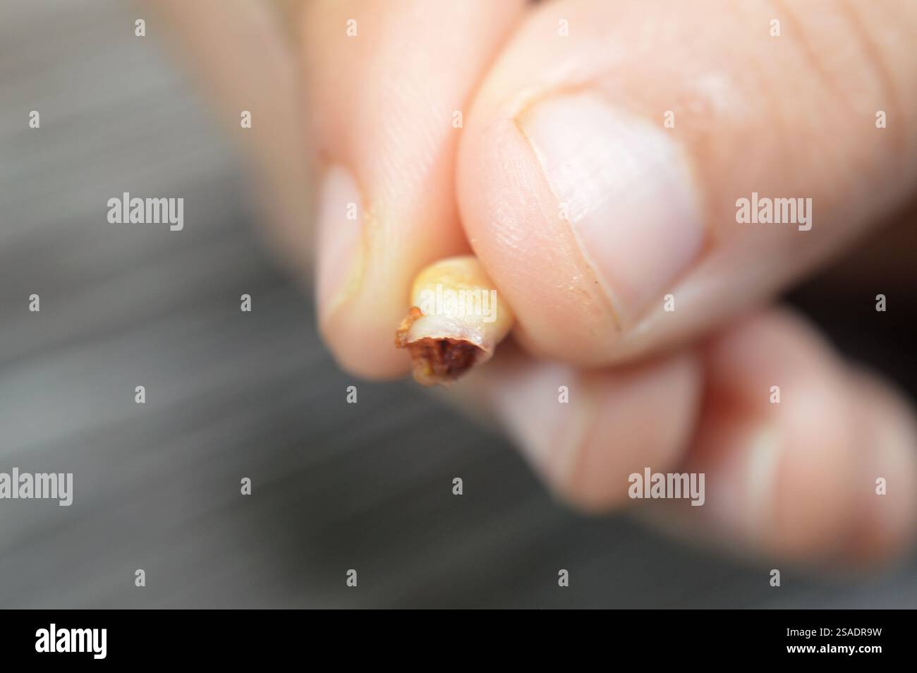 Deciduous primary baby temporary tooth, the first set of teeth in the ...