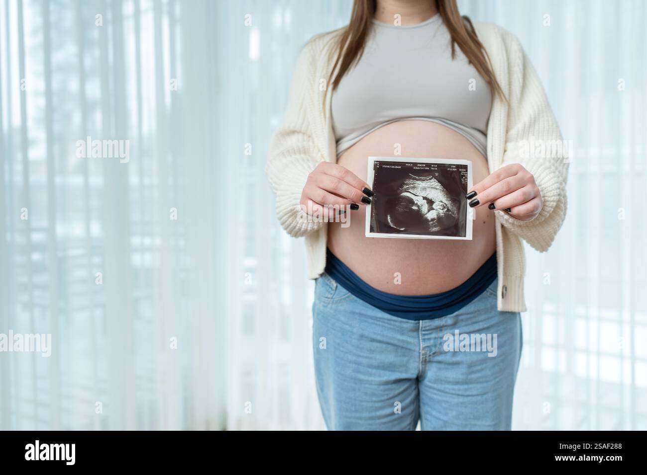 Young pregnant woman holding ultrasound scan photo of a fetus in front ...