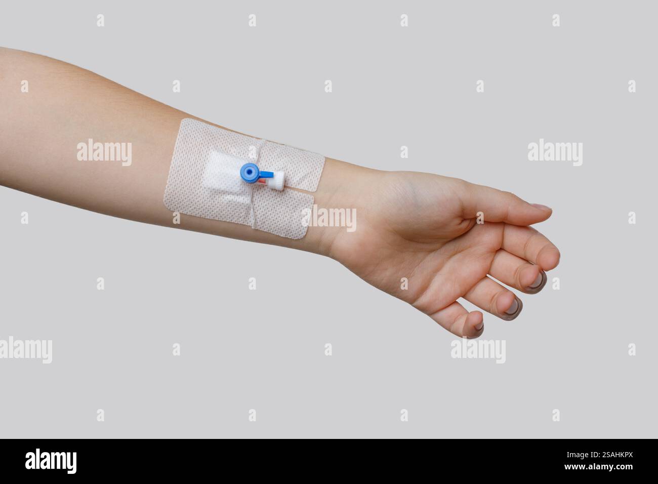 Medicine concept. Peripheral Catheter for Multiday Therapy Stock Photo ...