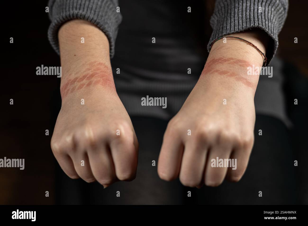 Rope marks on a child s hands the concept of domestic violence Stock ...