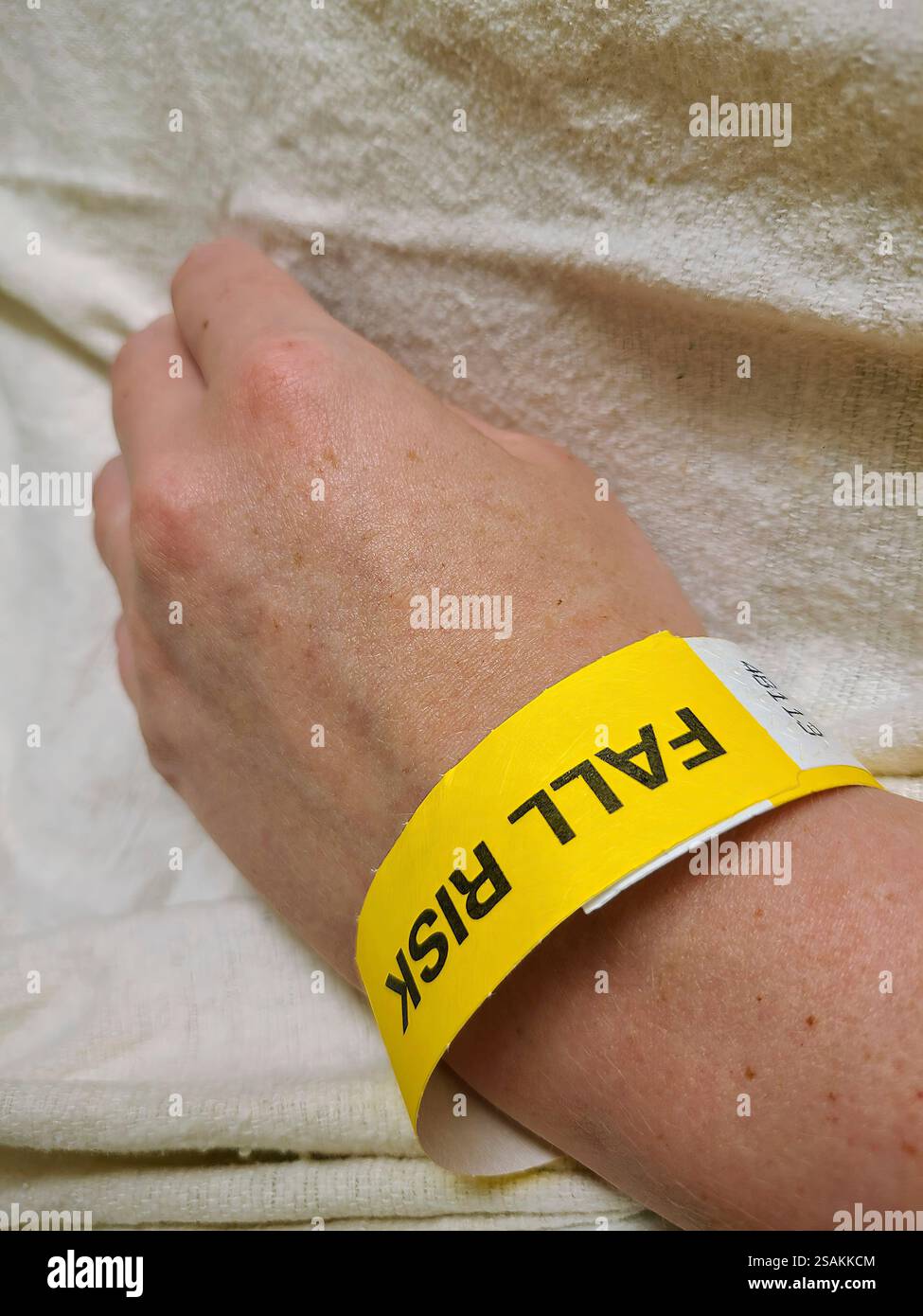 Fall Risk Wristband on Patient Wrist Eye-Level Perspective Stock Photo ...