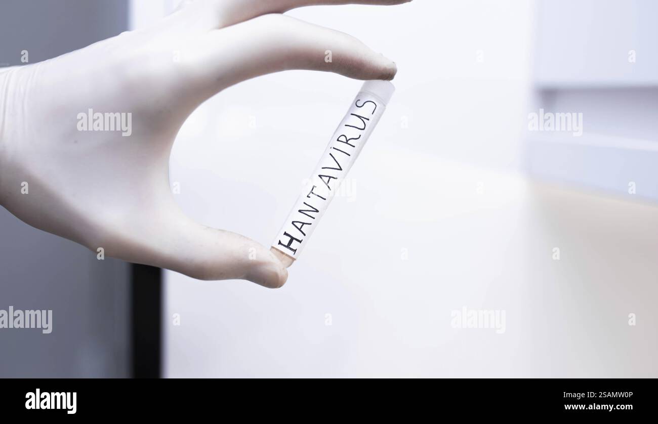 A gloved hand holding a Hantavirus test tube in a sterile lab setting ...