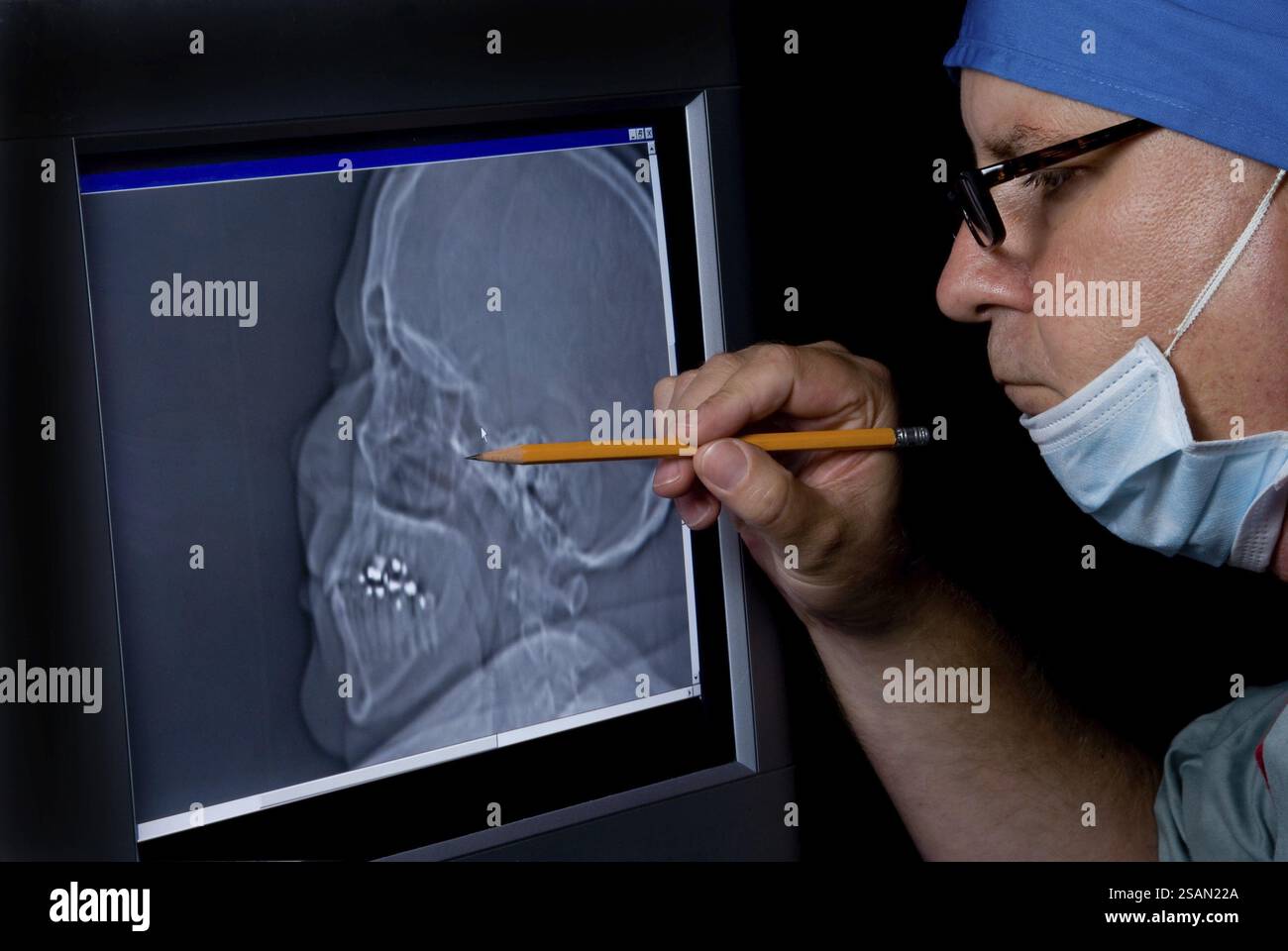 A medical doctor examining a CTT Scan Stock Photo - Alamy