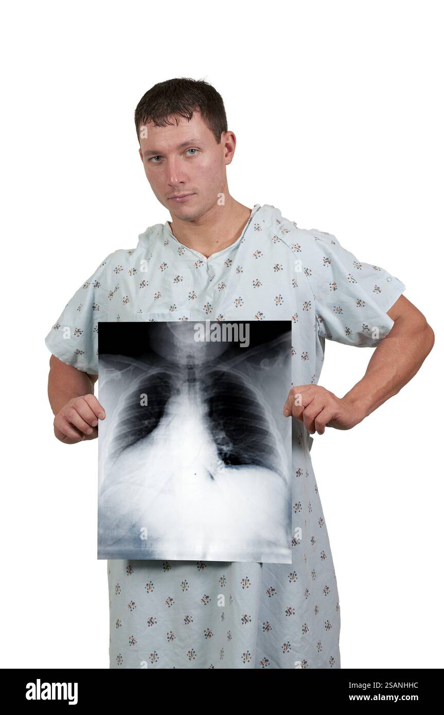 Handsome young man patient holding an x-ray Stock Photo - Alamy
