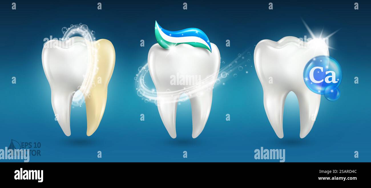 Set of dental teeth, 3d models dental examination teeth, whitening and ...