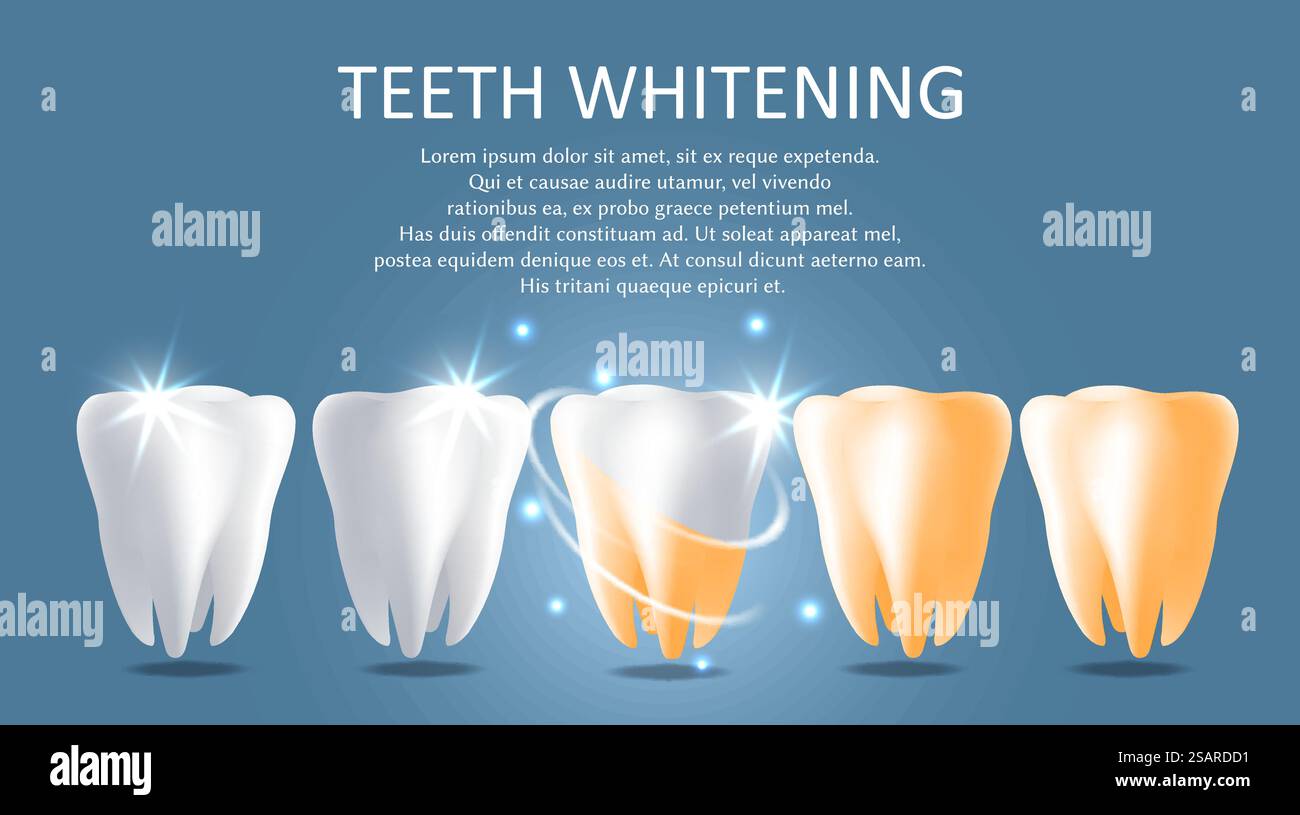 Teeth whitening vector medical poster banner template. Professional ...