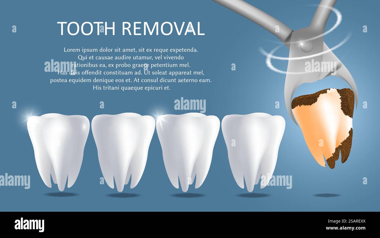 Tooth removal vector medical poster banner template. White healthy ...