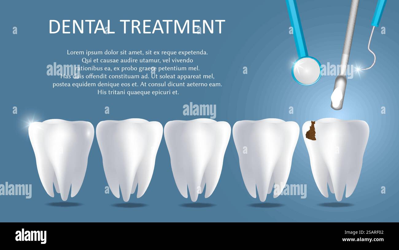 Dental treatment vector medical poster banner template. Realistic human ...