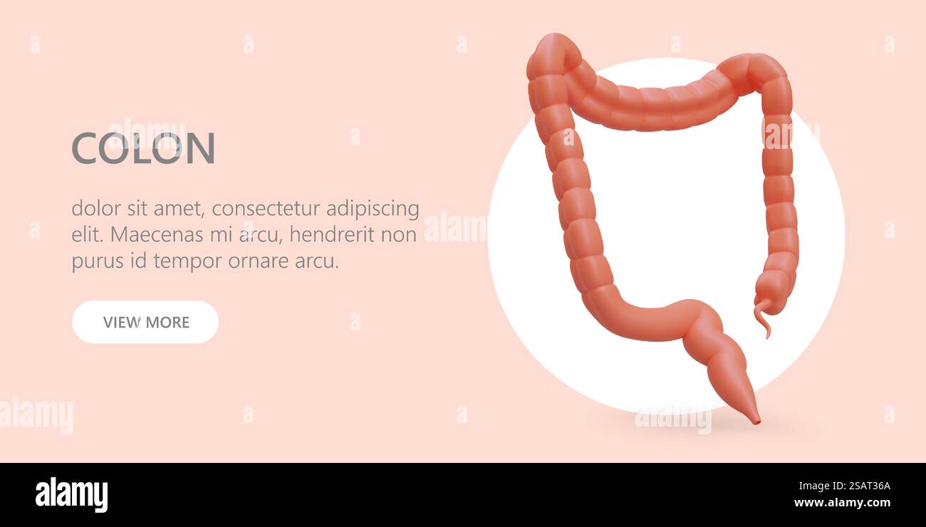 Large intestine, colon with appendix. Colonoscopy, biopsy, treatment ...