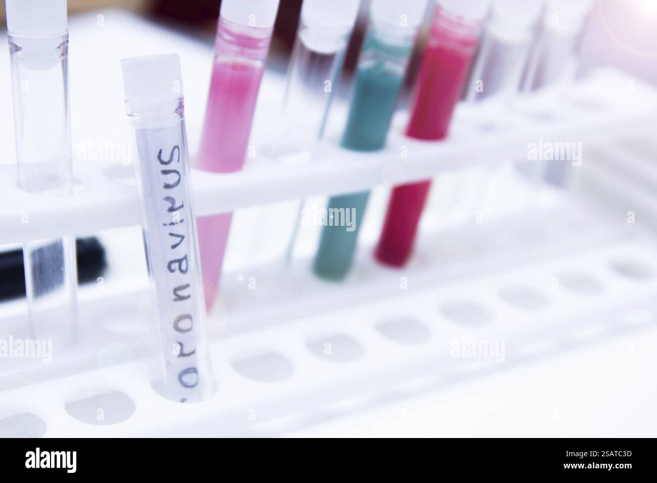 Test tubes with one labeled 'coronavirus' in a lab rack Stock Photo - Alamy