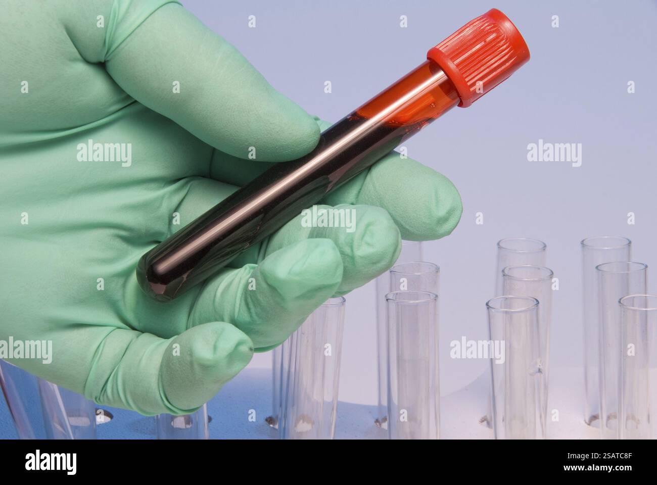 A scientist handling a blood sample in a test tube Stock Photo - Alamy