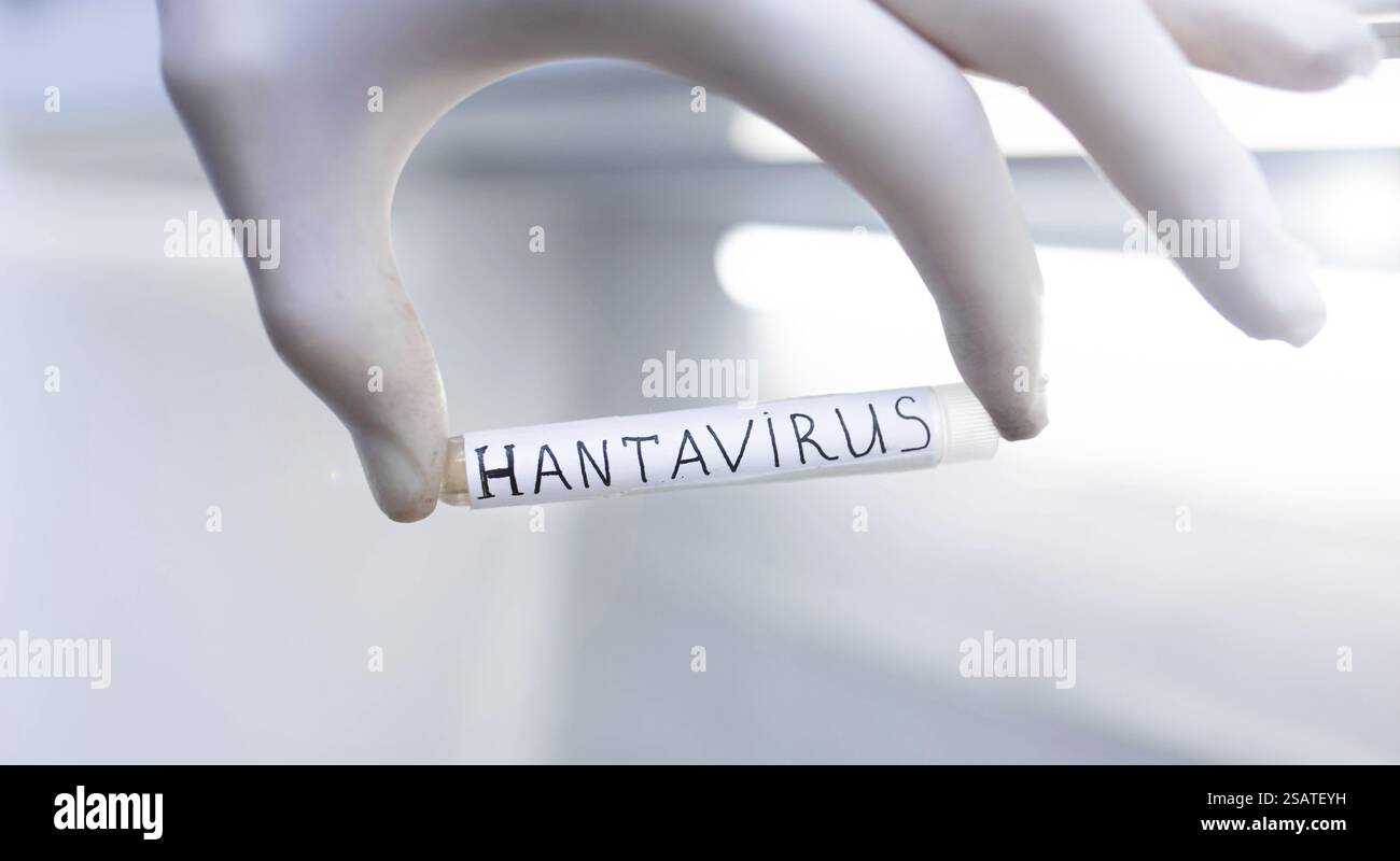 A gloved hand holding a Hantavirus labeled test tube in a lab setting ...