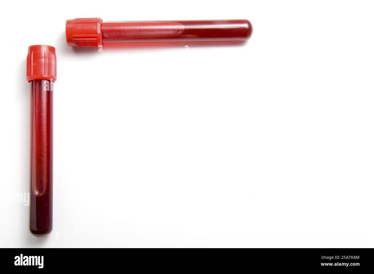 Blood samples in glass laboratory test tubes Stock Photo - Alamy