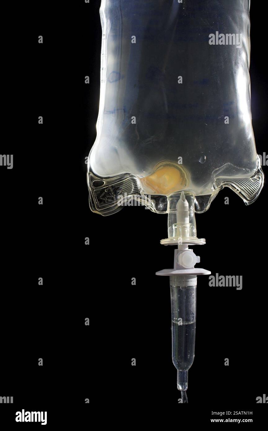 A medical IV slowly dripping from a bag of fluid Stock Photo - Alamy
