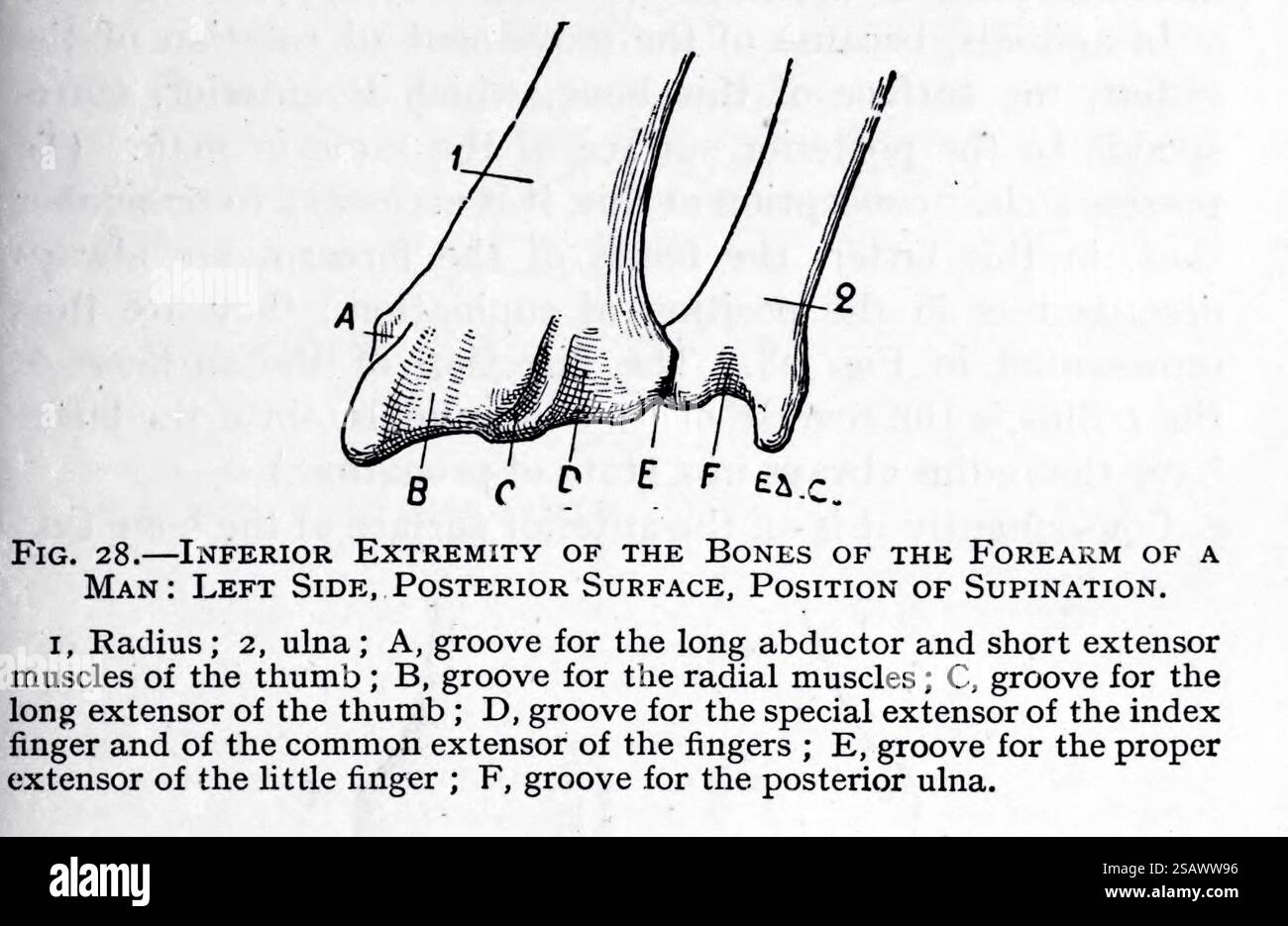 INFERIOR EXTREMITY OF THE BONES OF THE FOREARM OF A MAN: LEFT SIDE ...