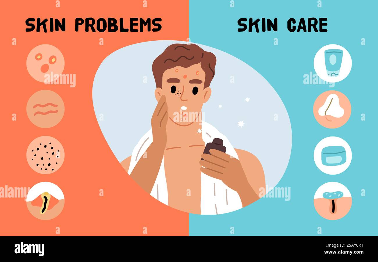 Acne prevention infographic. Man with problem face skin. Guy with ...