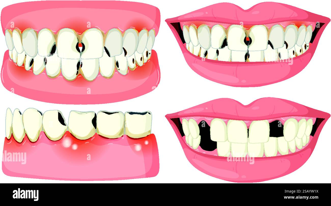 Vector art depicting various dental conditions and treatments Stock ...