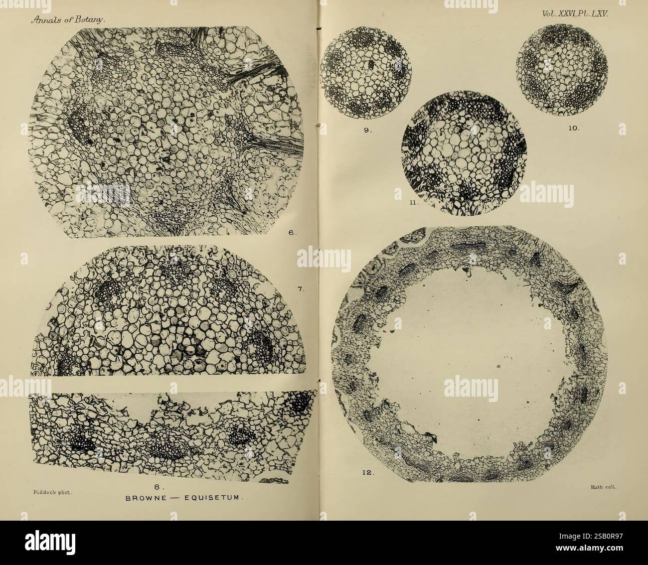 Series presents various magnified views hi-res stock photography and ...