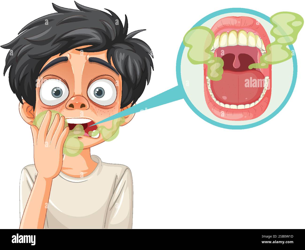 Halitosis bad breath illustration Cut Out Stock Images & Pictures - Alamy