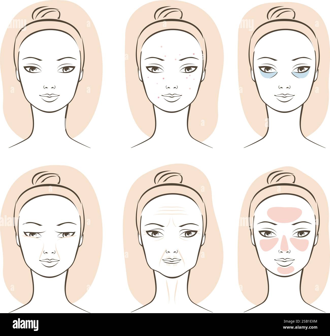 Facial skin problems: acne, blackheads, pimples, dark circles, ptosis ...