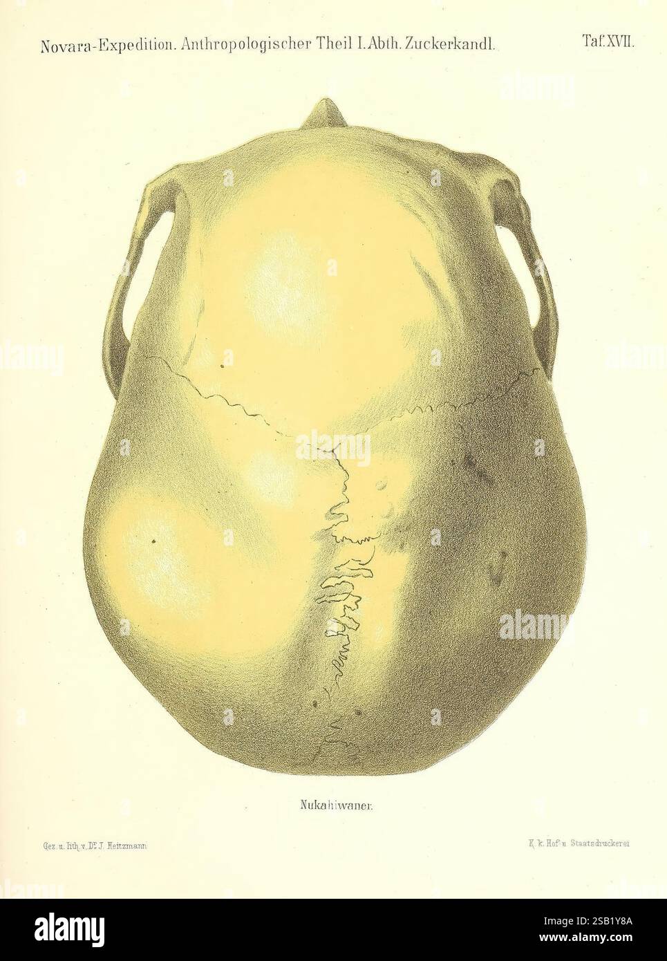 Prominent sutures hi-res stock photography and images - Alamy