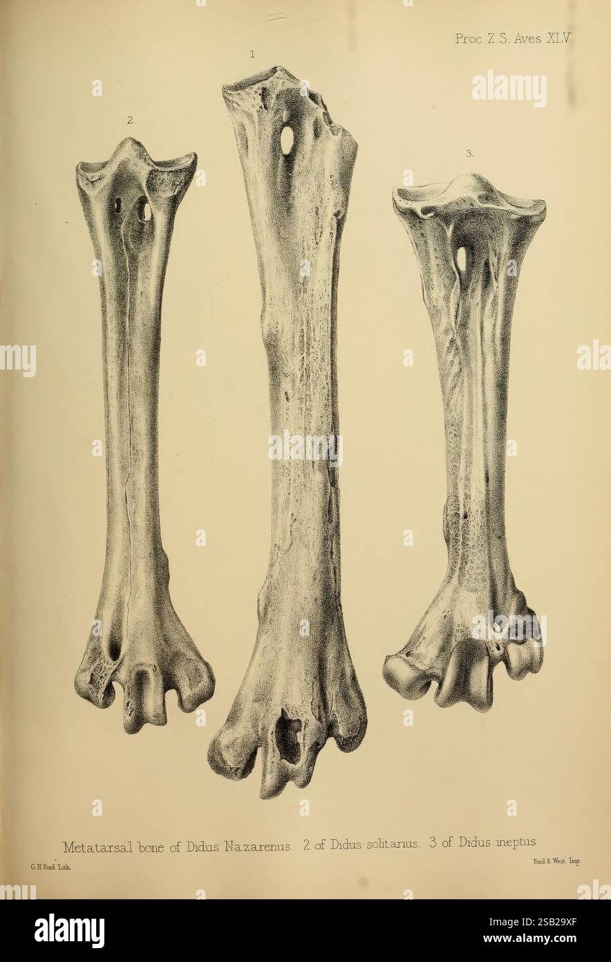 Illustration showcases three metatarsal bones hi-res stock photography ...