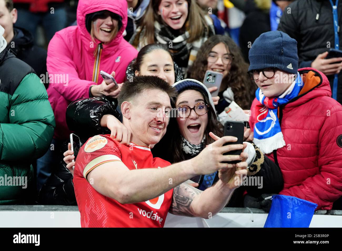 **Editors note: Blood Shown** Wales' Josh Adams poses for photos with ...