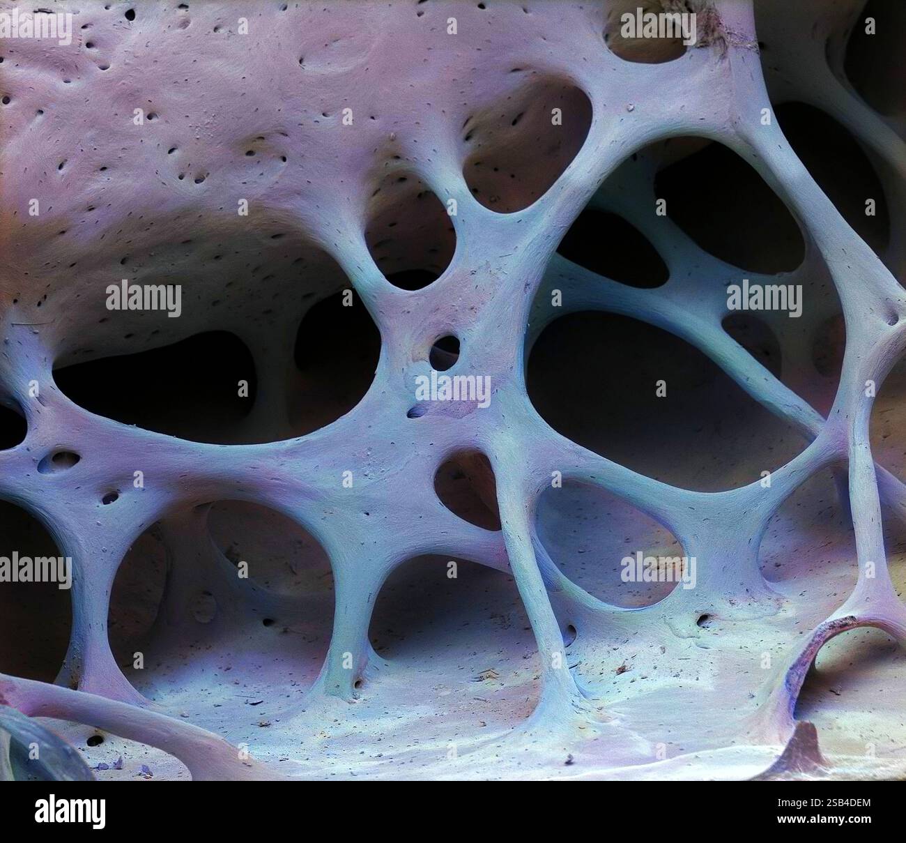 Bone cross section, sem hi-res stock photography and images - Alamy