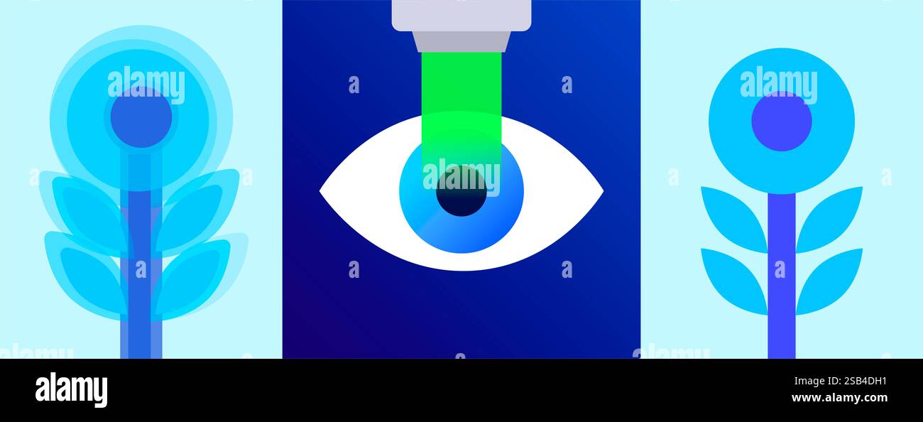Illustration of LASIK (Laser-Assisted In Situ Keratomileusis) also ...