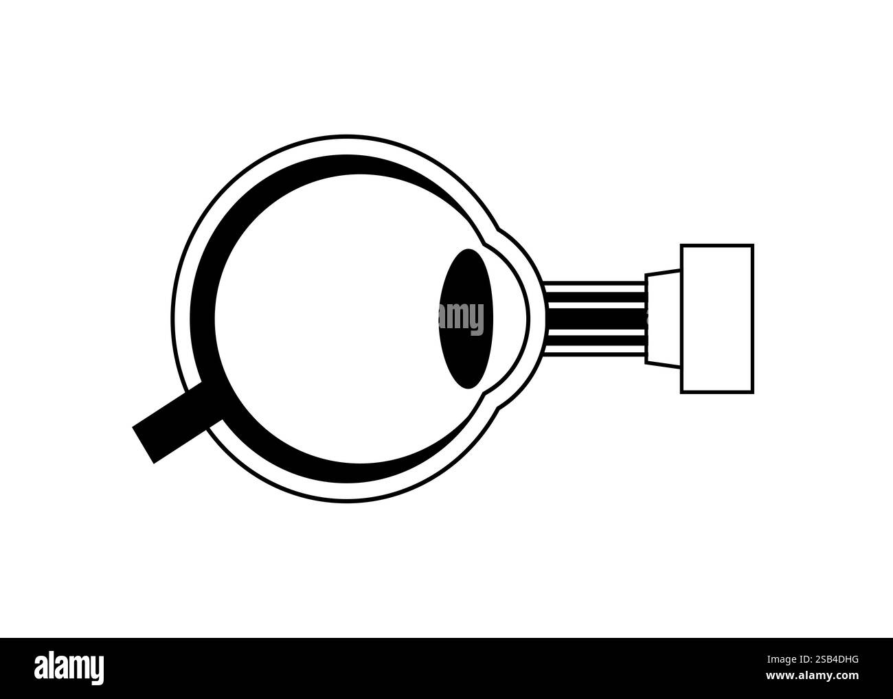 Illustration of LASIK (Laser-Assisted In Situ Keratomileusis) also ...