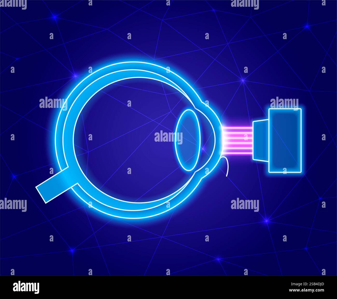 Illustration of LASIK (Laser-Assisted In Situ Keratomileusis) also ...