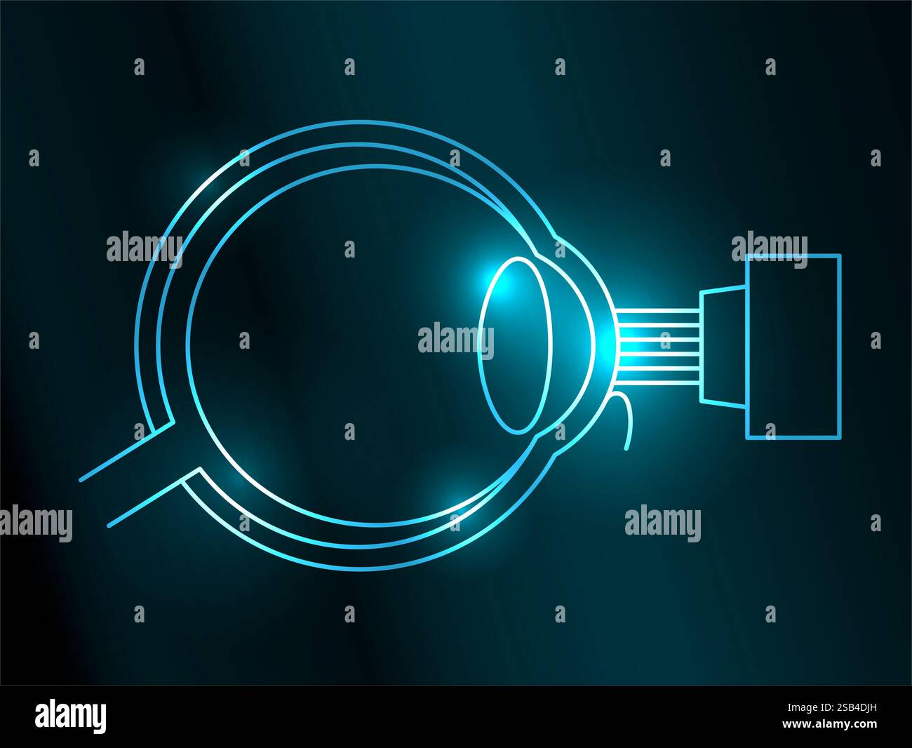 Illustration of LASIK (Laser-Assisted In Situ Keratomileusis) also ...