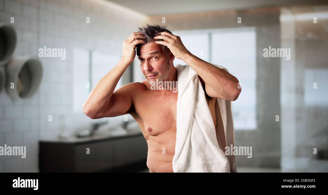 Man Suffering From Hair Loss. Dermatology Damaged Scalp Stock Photo - Alamy