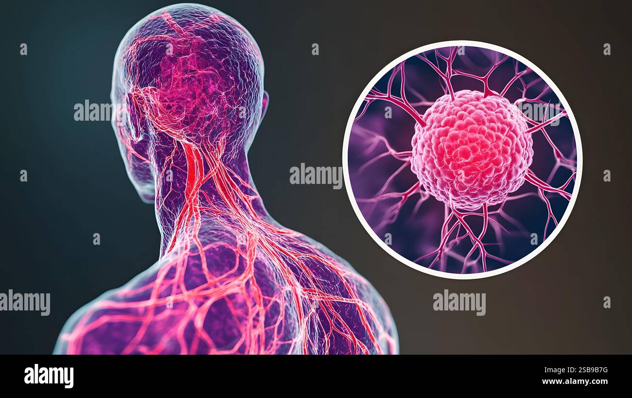 Highly detailed and digital showcasing the nerve inflammation and ...