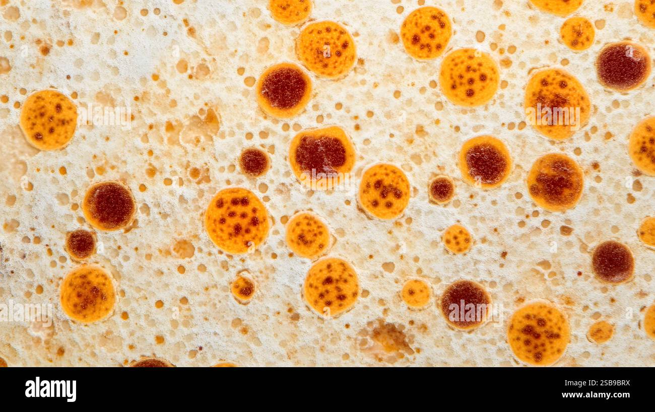 Closeup view of circular patterns of characteristic herpes zoster ...