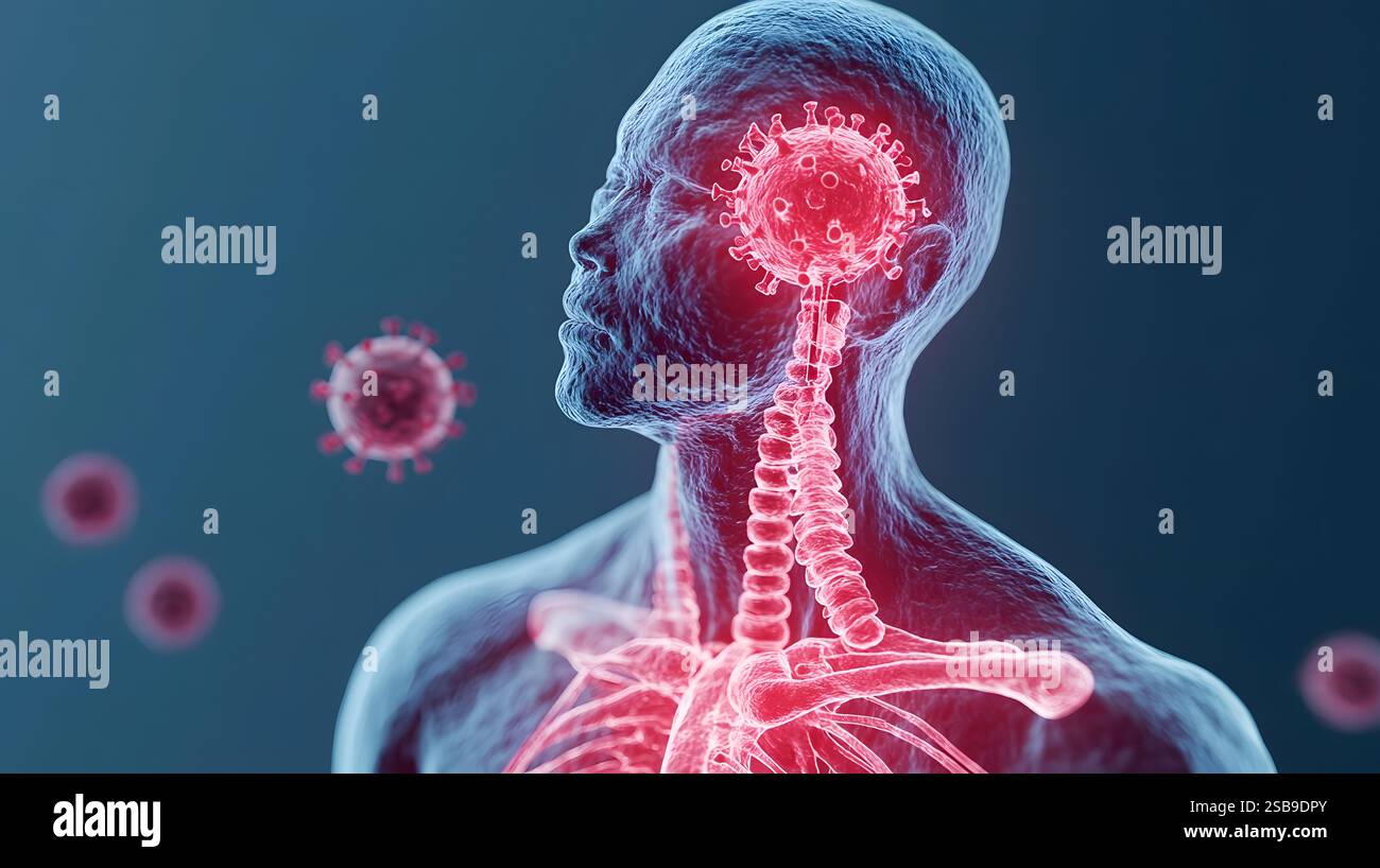 Vivid Depicting Herpes Zoster Virus Affecting Nerve Pathways and ...